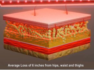 Red Light Therapy Before And After | Mississippi